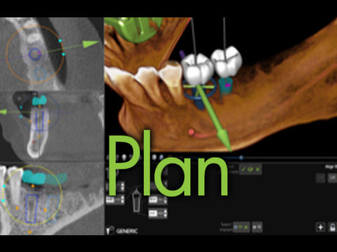 Learn More about the X-Guide Dynamic 3D Navigation System